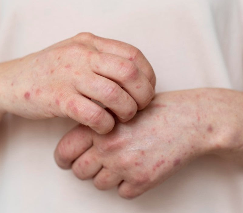 How to Cure Cuticle Infection at Home? – Nghia Nippers USA